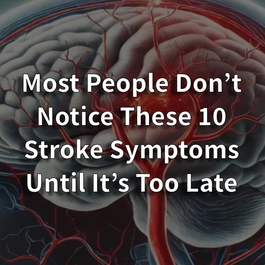 10 Life Saving Tips for Lowering Stroke Risk & Early Signs of Stroke ...